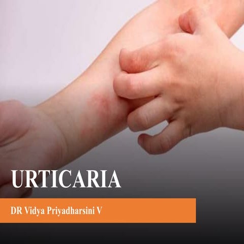 URTICARIA Symphosium final presentation.pptx