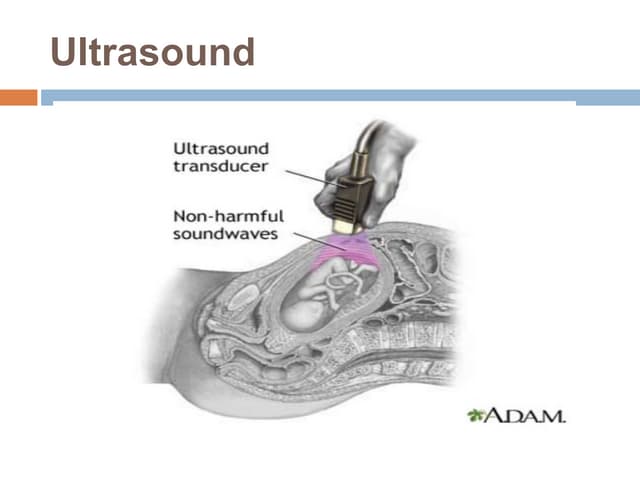 Ultrasound | PPTX