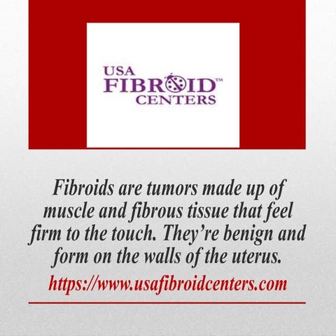 Fibroid Center NYC: Local Care and Awareness for Women’s Uterine Health ...