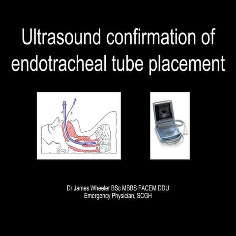 Ultrasound confirmation of endotracheal tube placement | PPTX