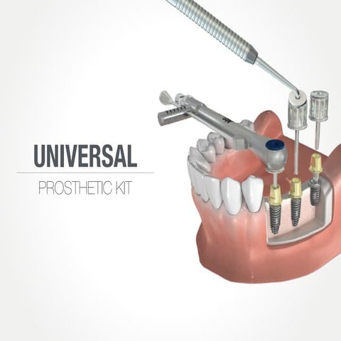 User guide universal prosthetic kit -151207 | PDF