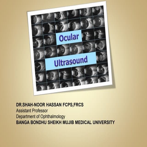 A quick guide to Ophthalmic Ultrasound/ B-Scan interpretation | PPTX
