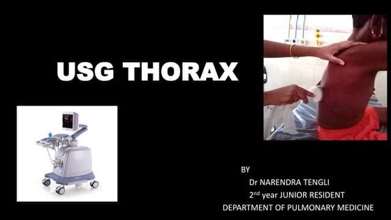 Normal Lung Ultrasound in Emergency: Technique and what to expect | PPT