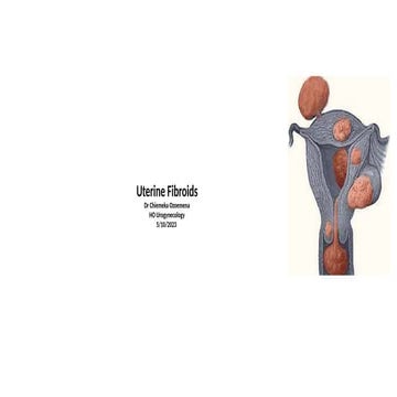 Uterine fibroids | PPTX