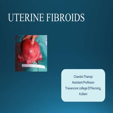 Uterine fibroids | PPTX