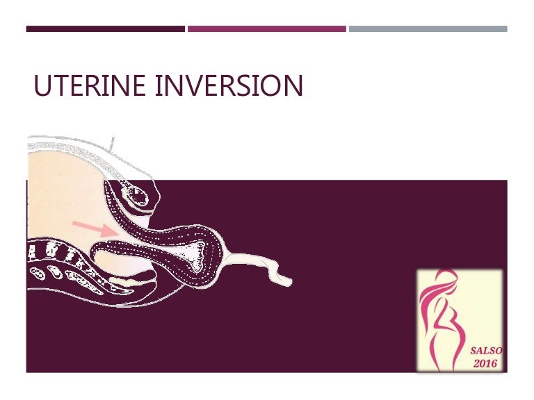 Uterine inversion 2016