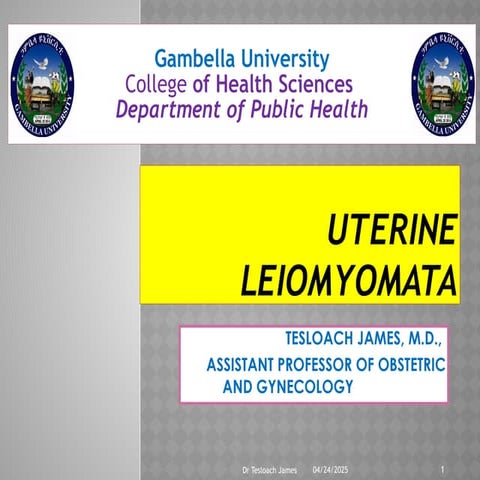 Uterine Leiomyomata at Gambella Uni.pptx
