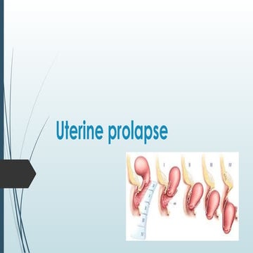 Uterine prolapse with definition, stages,management | PPTX
