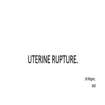 UTERINE RUPTURE.pptx