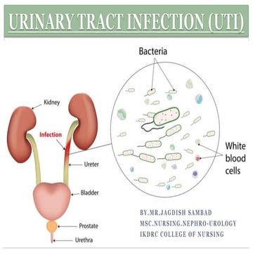 Urinary tract infection (UTI) | PPTX