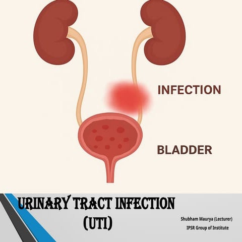 UTI (Urinary Tract Infection) Explained | Causes, Symptoms, Diagnosis ...