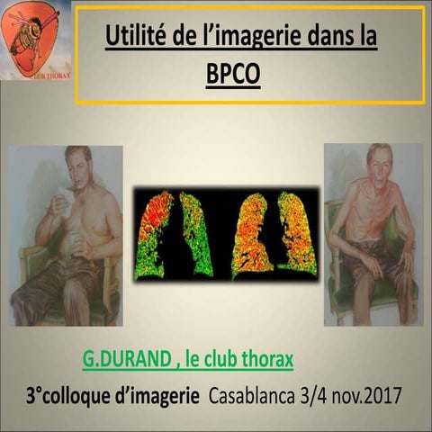 Syndrome bronchique | PDF