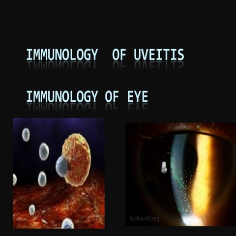 immunology of Uveitis based on nussenblatt | PPT