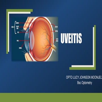Uveitis its clinical features and management.pptx