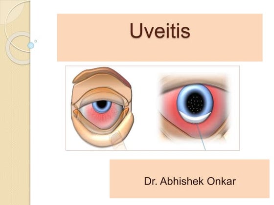 Panuveitis BEHCET DISEASE AAO Reading.pptx