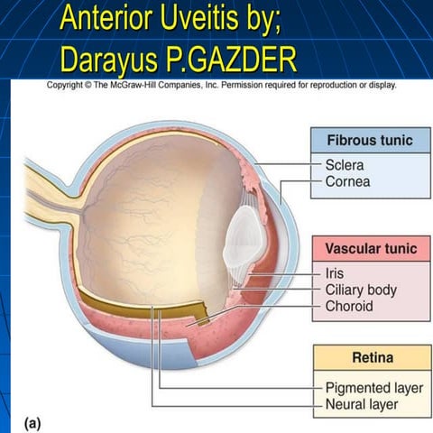 Uveitis Eye Presentation Darayus Deciphering Uveitis: An Overview Of