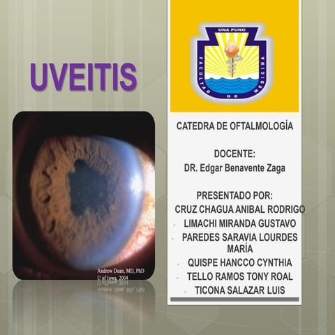 Uveitis oftalmologia | PPTX