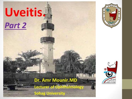 13. Uveitis.pptx