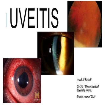 Uveitits classifications and Approach | PPTX