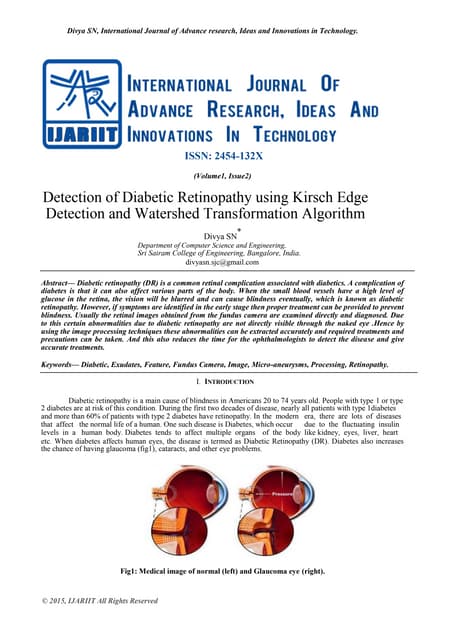 Exudates Detection From Digital Fundus Image Of Diabetic Retinopathy Pdf