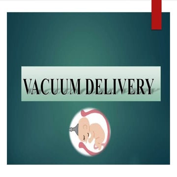 Vacuum delivery | PPTX