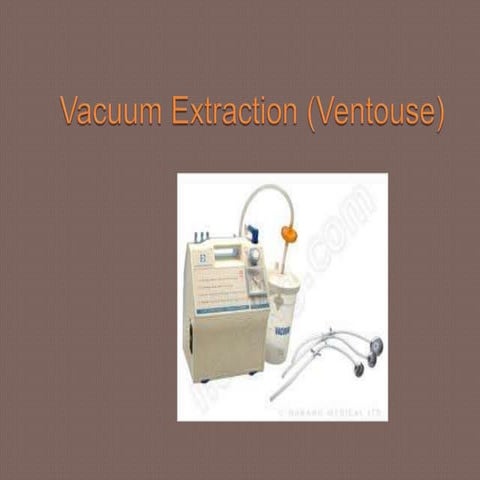 Vacuum extraction | PPTX