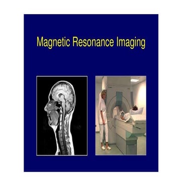 mri and amnesia-2.pptx