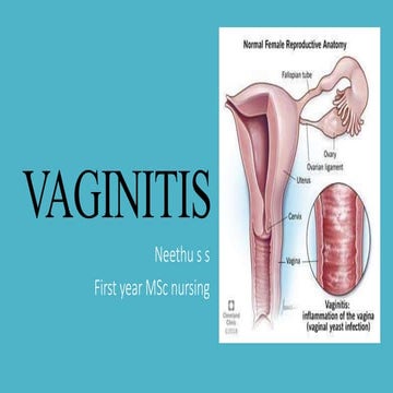 Vaginitis | PPTX