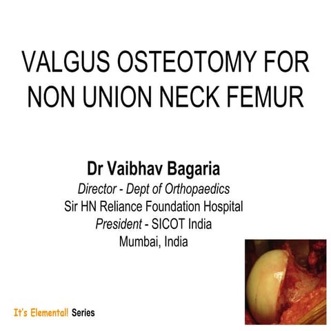 Valgus or abduction osteotomy for Non union Femur | PPTX