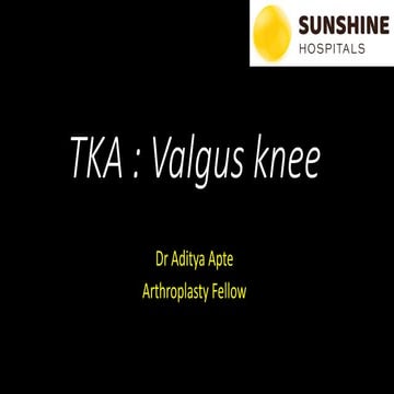 Valgus total knee arthroplasty | PPTX