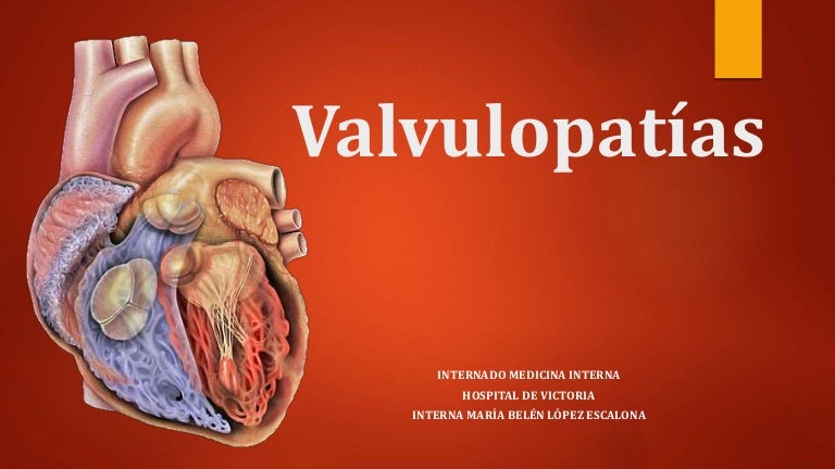 Valvulopatías