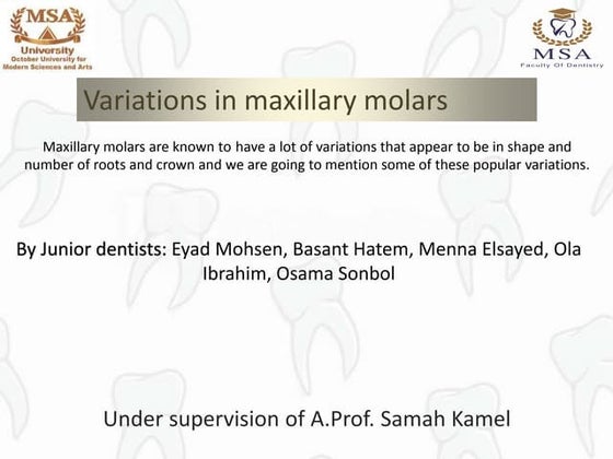 Variations of maxillary permenant molars | PPT