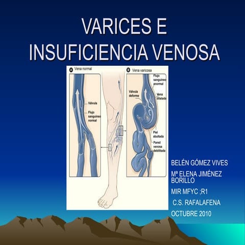 varices-e-insuficiencia-venosa________.ppt
