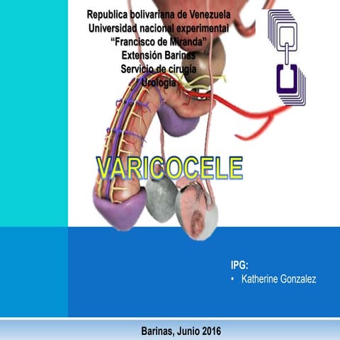 Varicocele | PPTX