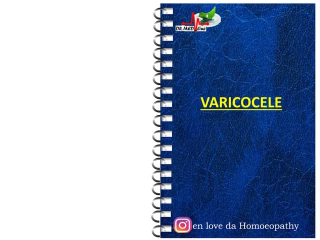 Varicocele.ppt