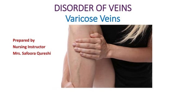 Varicose_Veins_Presentation and how to identify the varicose veins | PPT