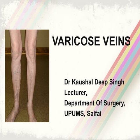 Anatomy of venous system of lower limb | PPTX