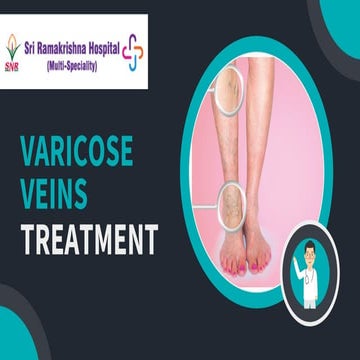 Varicose Vein Treatment | Embolectomy Procedure in Coimbatore | PDF