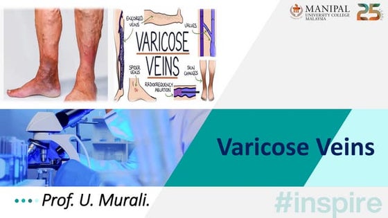 Varicose venous disease of lower limbs (lecture vasilevsky v.p.) | PDF