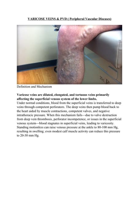 AMPUTATIONS- Definition, Types, procedures, indications | DOCX ...