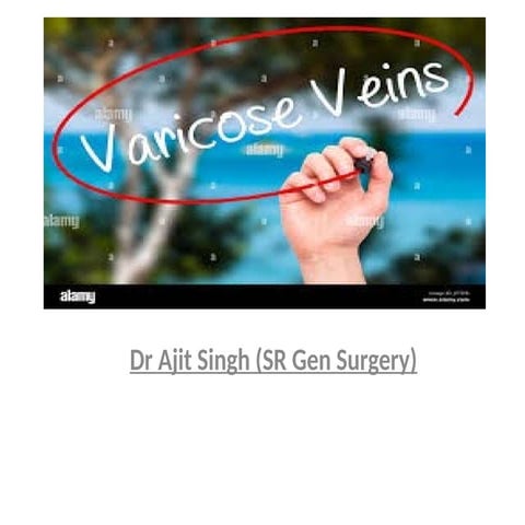 VENOUS CUT DOWN Procedure ppt presntation | PPTX