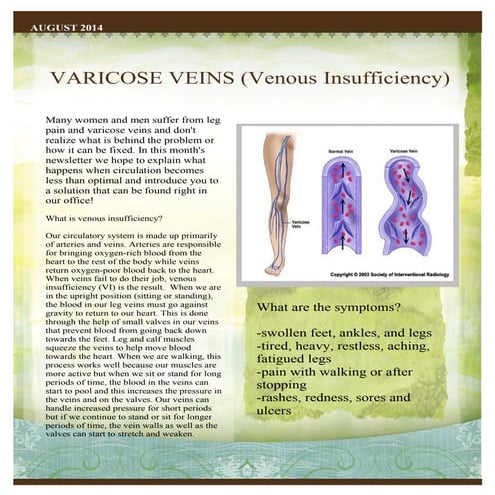 Varicose veins and compression stockings | PDF