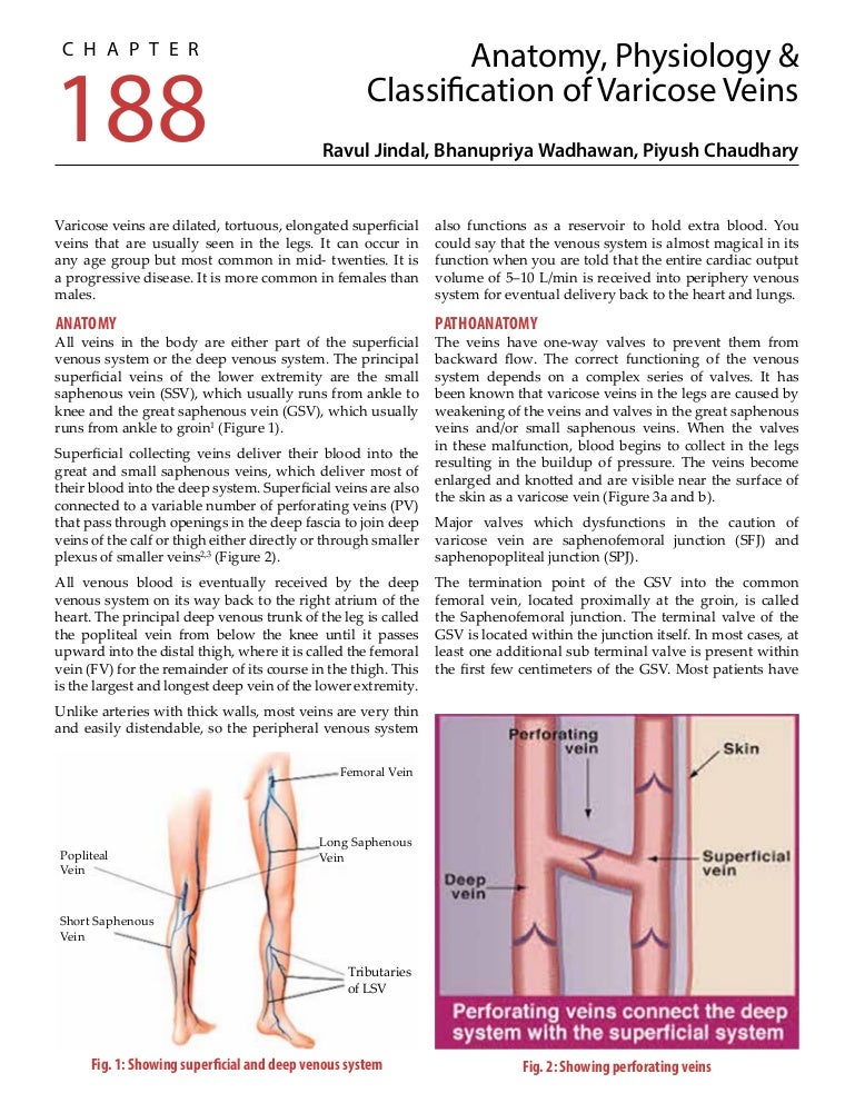 Varicose Vein Anatomy