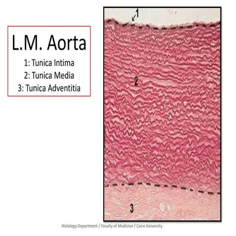 Aorta Slide Labeled