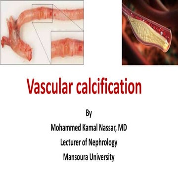 Vascular calcificationprof.mohammed kamal nassar, md | PPT