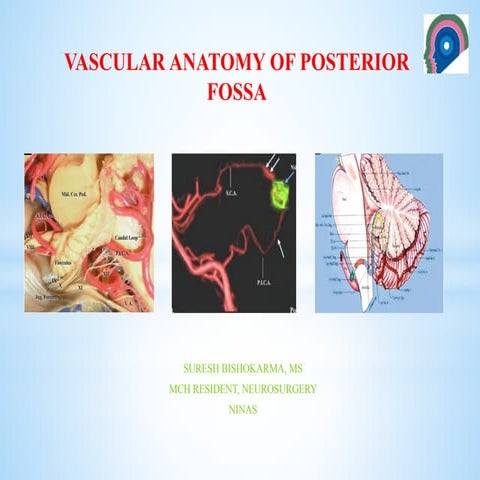Vascular anatomy of posterior fossa | PPTX