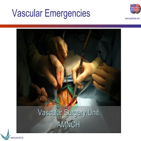 Vascular emergencies tcd sjh 2017 | PPT