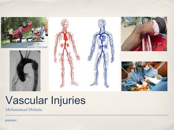 Vascular injuries and management 2018 | PPT