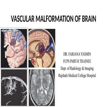 VASCULAR MALFORMATION OF BRAIN RADIOLOGY.pptx