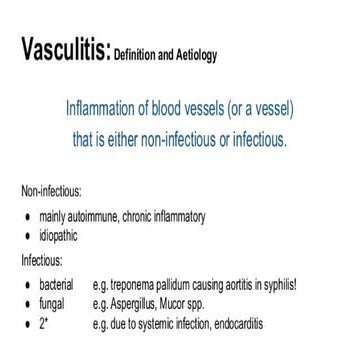 Vasculitis | PPT